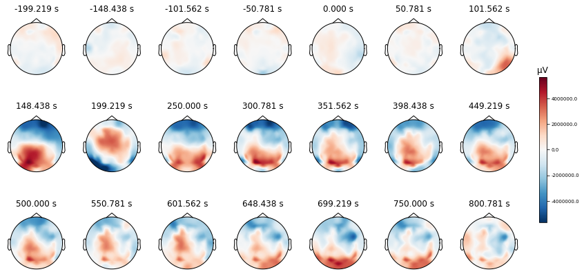 Intro to EEG Data Analysis | RK